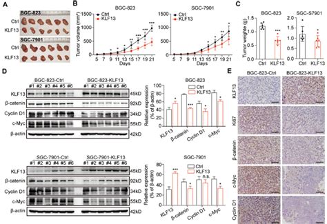 Klf13 Inhibited β Catenin Expression And Suppressed Gastric Cancer