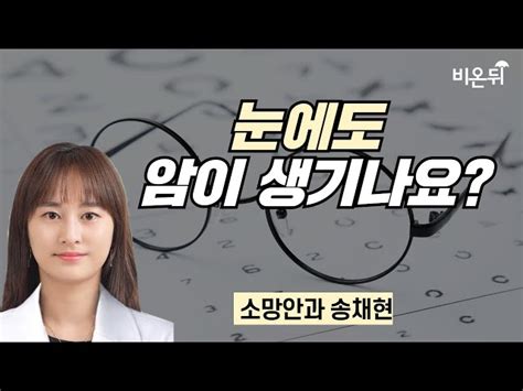 [비온뒤] 눈에도 암이 생기나요 송채현 원장 신당동 소망안과