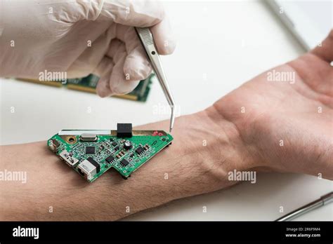 Hand With Implantation Of Micro Chip X Ray View Close Up Chipization Of People Control