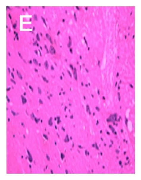 He Staining Of Rat Brain Tissue After Tbi ×200 A Normal B Model