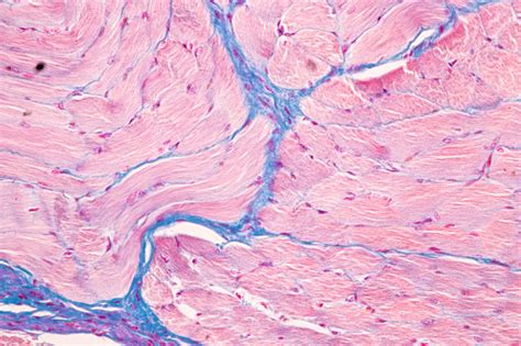 지방 조직 인간 연한 구개 인간 뼈 인간 및 줄무늬 근육 인간을 현미경으로 관찰합니다 골화에 대한 스톡 사진 및 기타 이미지
