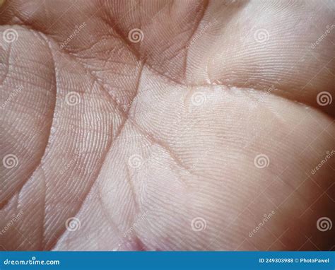 Macro Human Skin Texture Caucasian Healthy Skin Dermatitis Concept