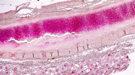 Bone Metabolism Alexion Global Site