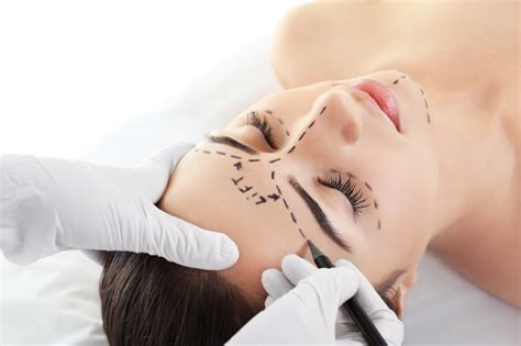 Pdo Beauty Threads Lift Forehead Lines Parkland