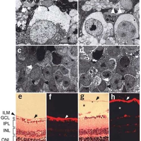 Morphology Of Reactive Astrocytes Müller Glial Cells And The Ilm In