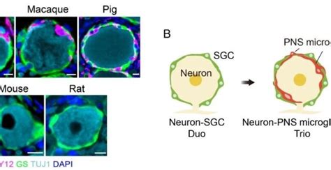 我国科研团队发现外周神经系统存在新型“免疫哨兵” 新华社 腾讯新闻