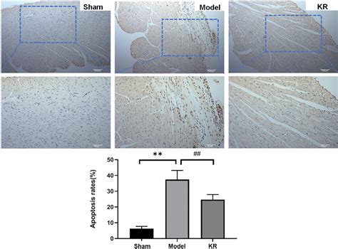 Kr Reduces Cardiomyocyte Apoptosis Via Tunel Staining Light Blue The
