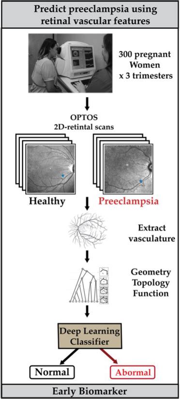 1144 Predicting Preeclampsia And Gestational Hypertension Using The