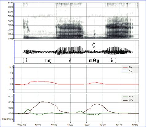 Spectrogram Audio Waveform Intraoral Pressure Po Oral Airflow
