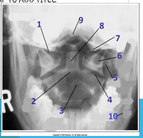 Ap Open Mouth Image Eval Exam 5 Diagram Quizlet