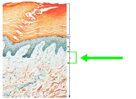 Dermis Flashcards Quizlet