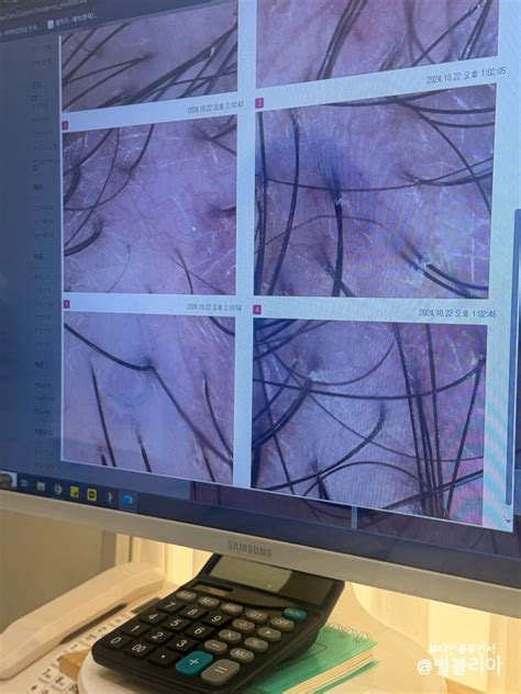 대구두피관리 샵 헤드스파k 롯데백화점 상인점에서 두피각질 탈모샴푸까지 네이버 블로그