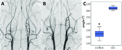 Dsa In Live Mice Demonstrates Differences In Neurovascular Anatomy In
