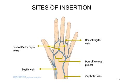 Vascular Access Devices Ceo Webrn Page 11 Flip Pdf Online Pubhtml5