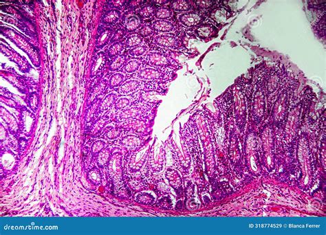 A Photomicrograph Of Human Large Intestine Under Microscope Stock Image