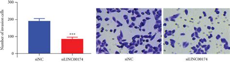 Silencing Or Overexpression Of Linc00174 Affects The Growth Migration