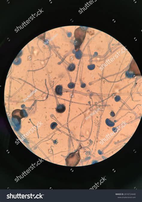 Aspergillus Under Microscope 40x Labeled