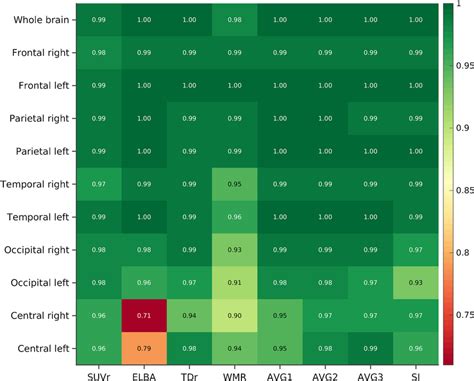 Regional And Whole Brain Auc Performance Average Over Bootstrap