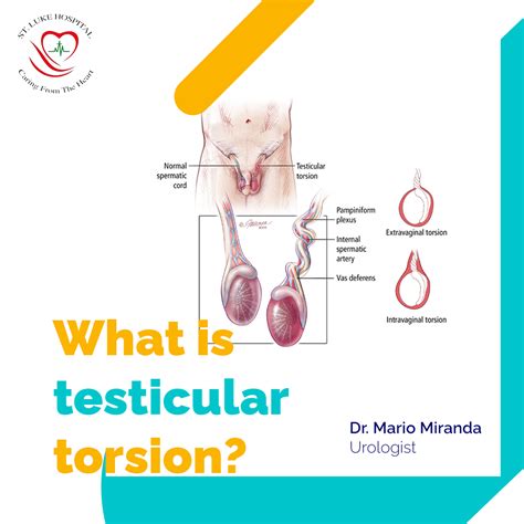 Testicular Torsion Occurs Dr Mario Miranda Urologist