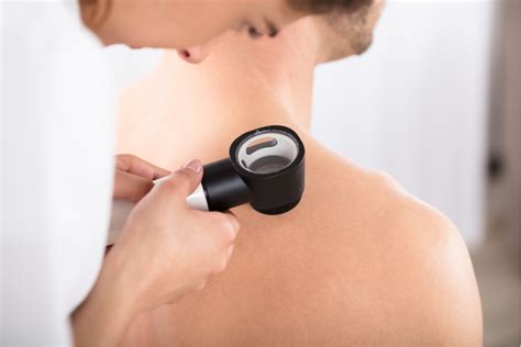 Mụn Nhọt Ở Lưng Nguy Hiểm Không Cách Trị Dứt Điểm 100