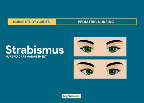 Strabismus Nursing Care Planning And Management Nurseslabs