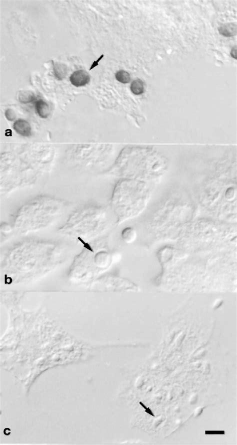 Differential Interference Contrast Light Micrographs Of Chicken