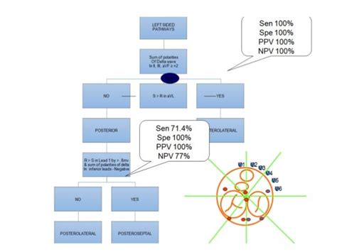 Localization Of Wpw Accessory Pathway By Surface Ecg