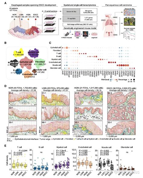 文献分享 食管癌发生的单细胞多阶段空间演化图谱（xenium） 知乎