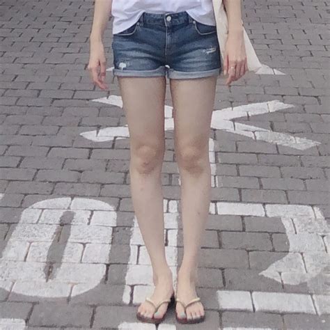 종아리보톡스 효과 본 지 한달 반 In 강남피부과 네이버 블로그