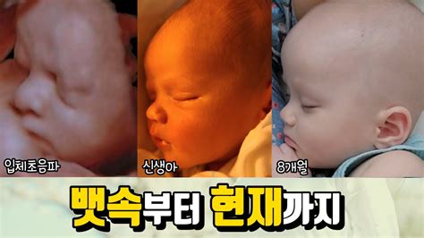 미국인 아빠 한국인 엄마 사이에서 태어난 아기 얼굴 변화 Youtube