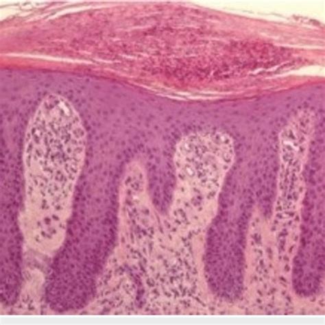 Histopathology Of Skin Lesions Using Hematoxylin And Eosin Staining Download Scientific Diagram
