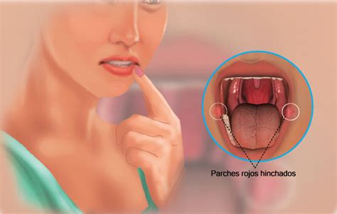 Health Condition Symptoms Causes Treatment And More
