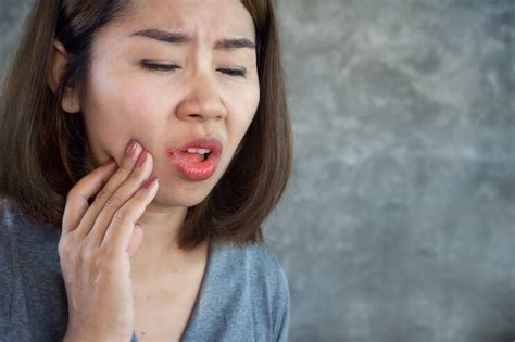 What Is The Fastest Way To Get Rid Of Angular Cheilitis