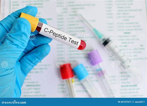 C Peptide Test Stock Image Image Of Hematology Health 65157671