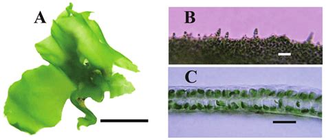 Ulva Rigida A Habit B Margin With Small Teeth C Transverse Download Scientific Diagram