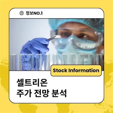 셀트리온 주가 전망 분석 투자 포인트