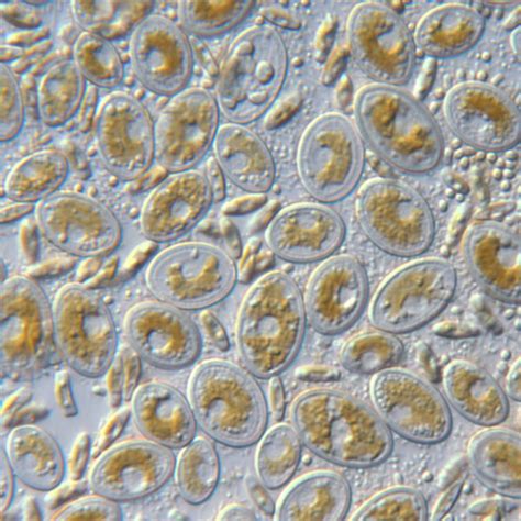 Cocconeis Placentula Species Diatoms Of North America