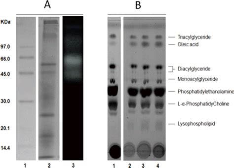 Protein Profile Electrophoretogram And Zymogram From Stomolophus Sp 2