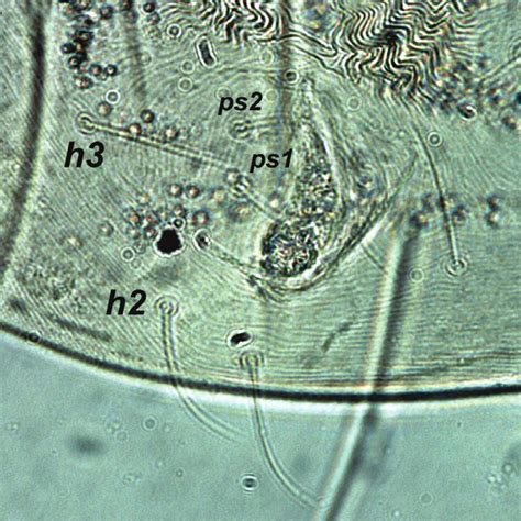 Shape Of Setae H 2 And H 3 Are Similar To Other Ventral Body Setae In
