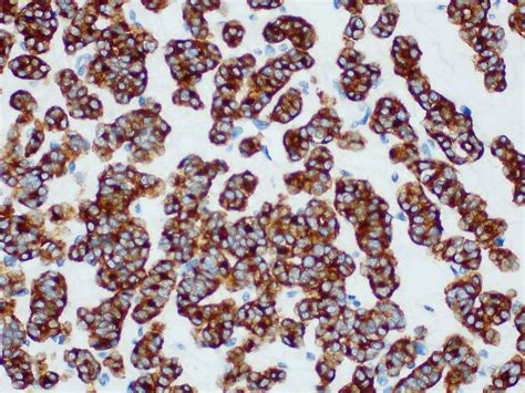 Micoscope Camera Lanoptik Technologies