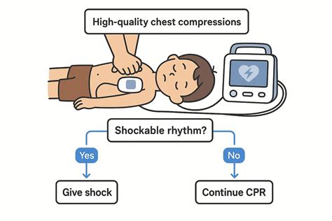 Mastering The Pals Cardiac Arrest Algorithm