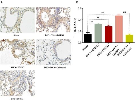 Celastrol Alleviates Airway Hyperresponsiveness And Inhibits Th17