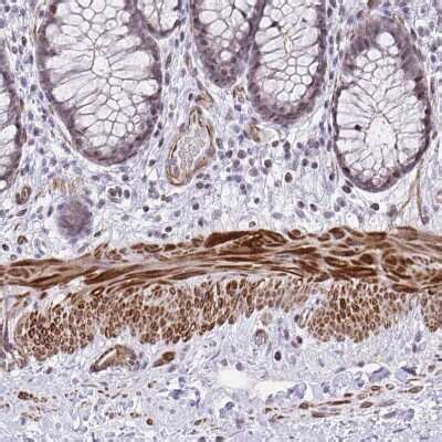 KCNN Antibody NBP Novus Biologicals