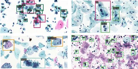 Figure 1 From Cervical Cell Clumps Detection In Cytology Images Using