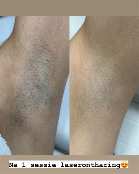 St Beauty はじめまして。🌙 Stbeautyでヘルスケアプロジェクトを担当している篠田るみです！ 具体的には、 身体の健康