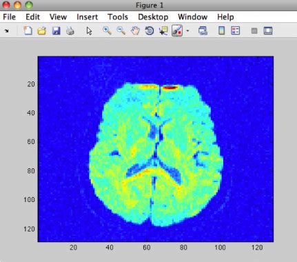 MatLab pour les radiologues et les étudiants PinkyBone
