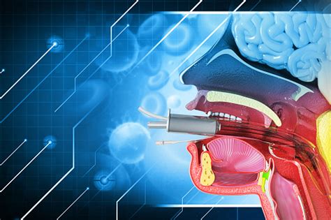 Intubasi Endotrakeal Dengan Latar Belakang Ilmiah Ilustrasi 3d Foto