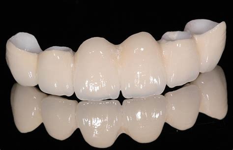 Керамические коронки клиника эстетической стоматологии Просмайл РУ