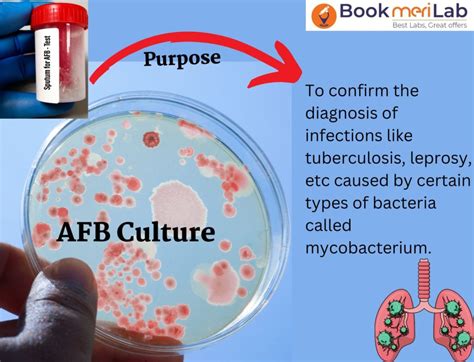 Afb Culture Test Price Purpose Results And More • Bookmerilab