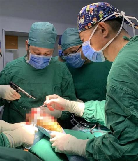 北京积水潭医院蒋协远团队完成首例肘关节表面置换定制假体植入 腾讯新闻
